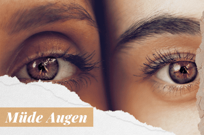 Talgknoten: Das Kannst Du Gegen Talgeinlagerungen Tun | Glød Magazin ...